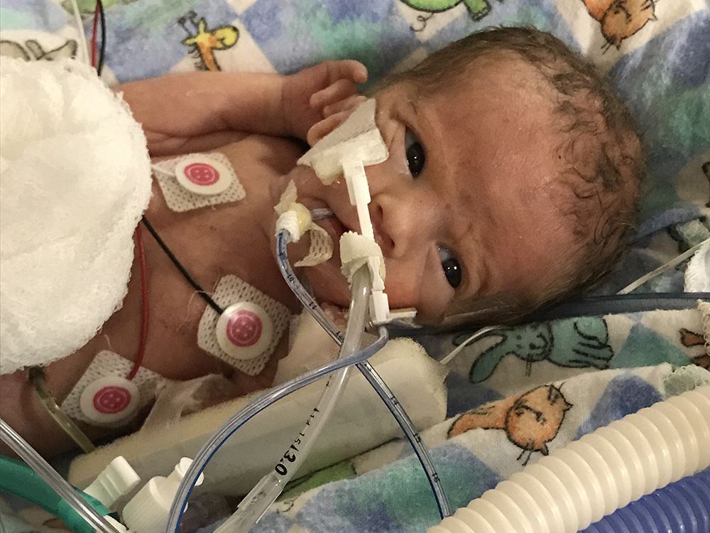 Donor-funded hospital equipment helps save kids’ lives in Calgary ...