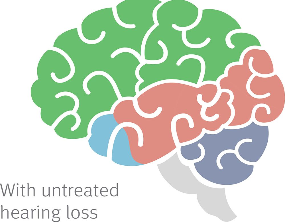 How hearing loss affects the brain, and what can be done about it ...