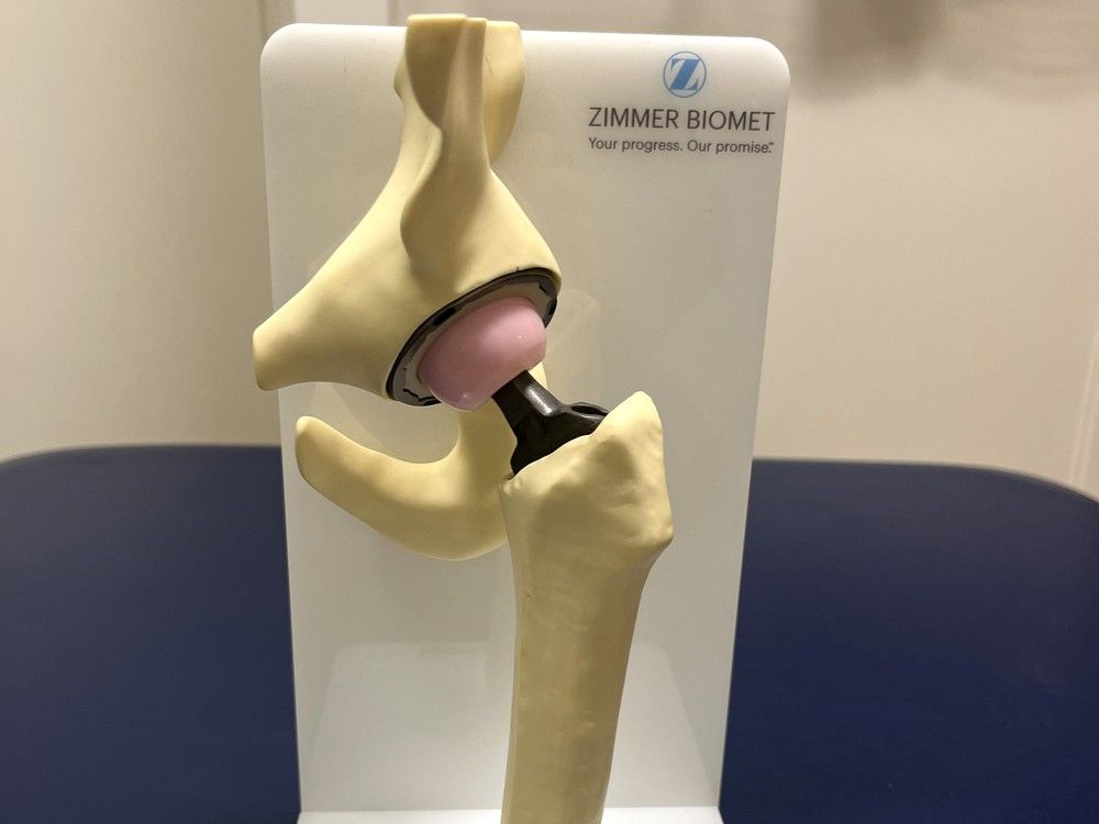 Calgary senior spends $35,000 for hip replacement in Lithuania ...