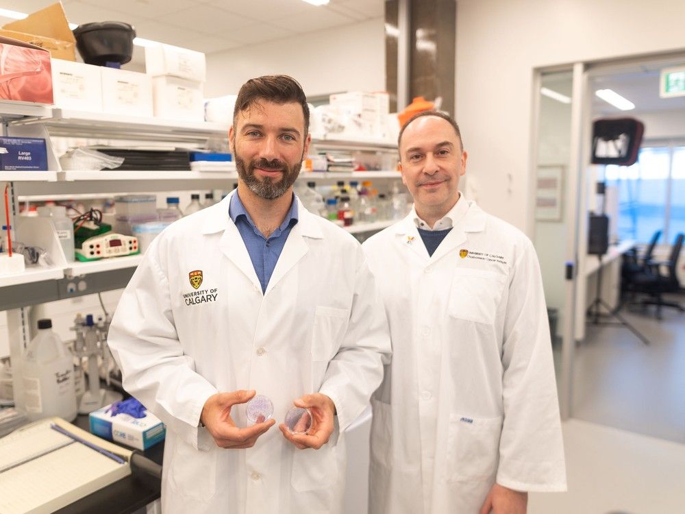 Toenails tell toxic tale of radon gas for U of C scientists | Calgary ...