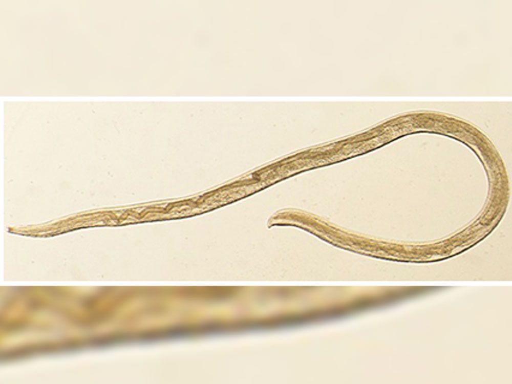 Woman had 14 parasitic worms pulled from her eye after rare infection ...