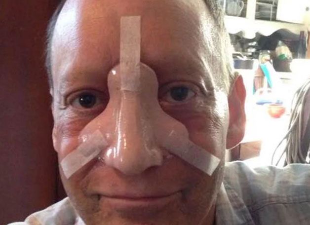 'Ray Donovan' actor Steve Bean loses battle with nose cancer ...