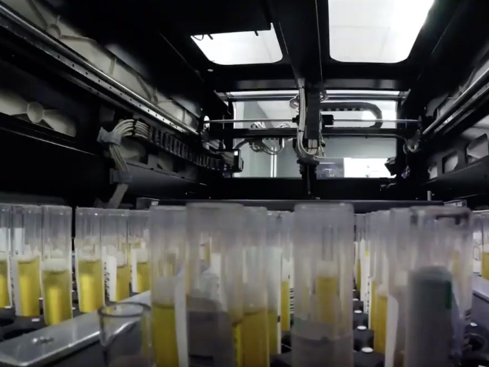 Dynalife's new equipment will boost testing capacity in Alberta ...