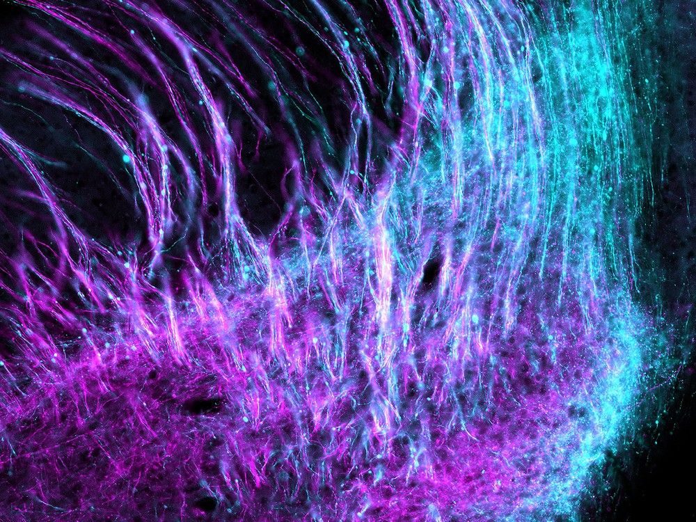 Connections art show brings neuroscience and art communities together ...