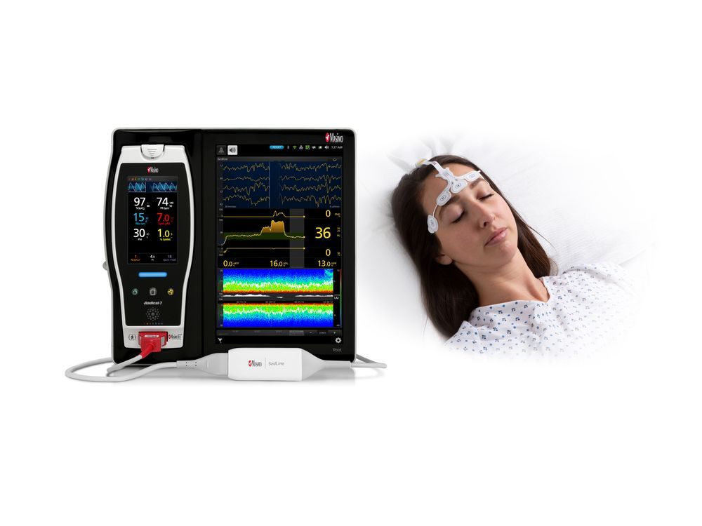 New Study Evaluates the Ability of Masimo SedLine® Brain Function ...