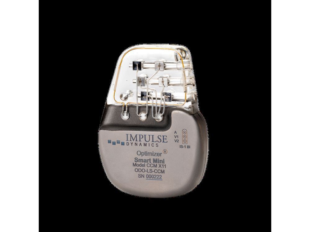 Impulse Dynamics Receives Full-Body MRI-Conditional Approval for ...