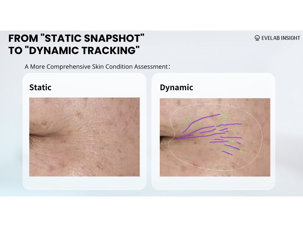 EveLab Insight Debuts Dynamic Wrinkle Detection Technology at VivaTech ...