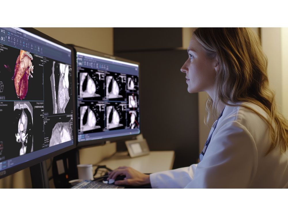 Philips Image Management 15 enhances diagnostic imaging access and ...