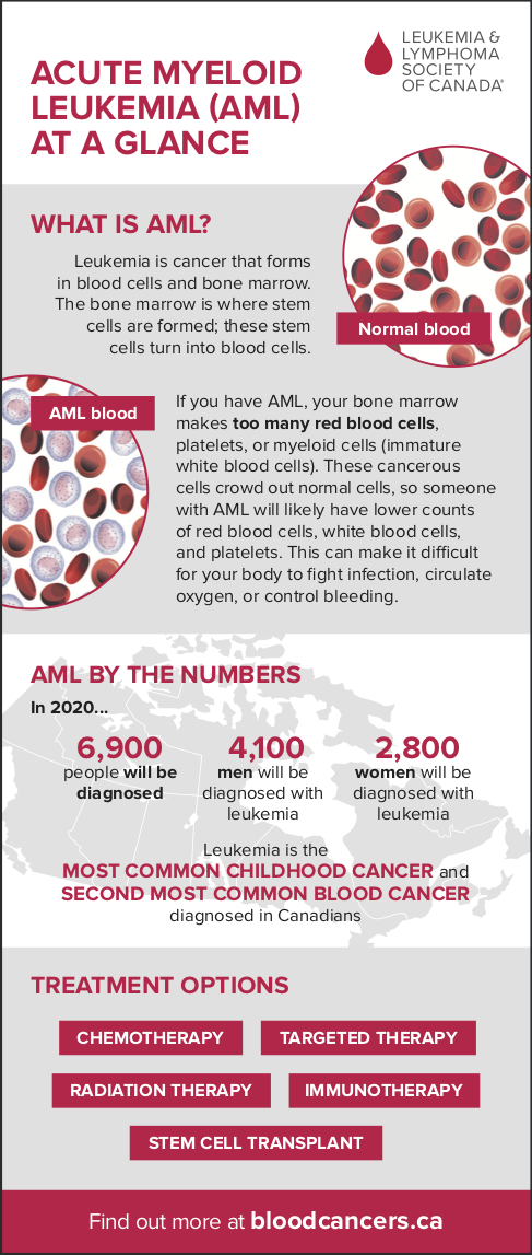 Acute Myeloid Leukemia (AML) at a glance | Brockville Recorder & Times