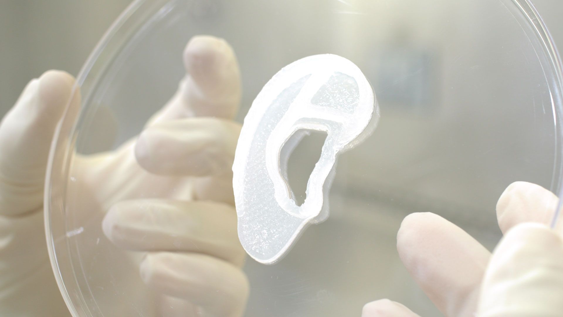 In a medical first, woman receives 3D-printed ear transplant from her ...