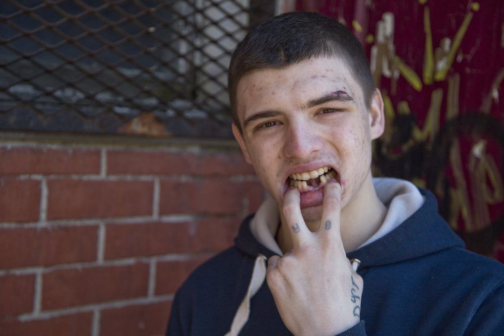 'A miracle': London man shot in face details ordeal, recovery | London ...