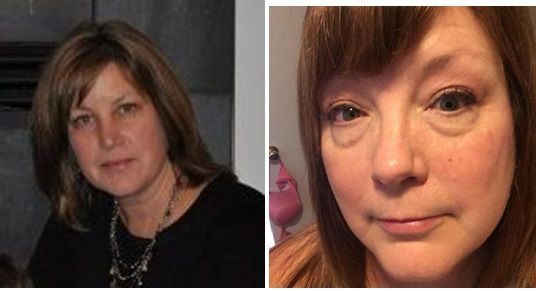 Woodstock nurse punished for scheduling suspended colleague | London ...