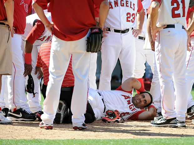 Baseball players have made freak injuries a habit | National Post