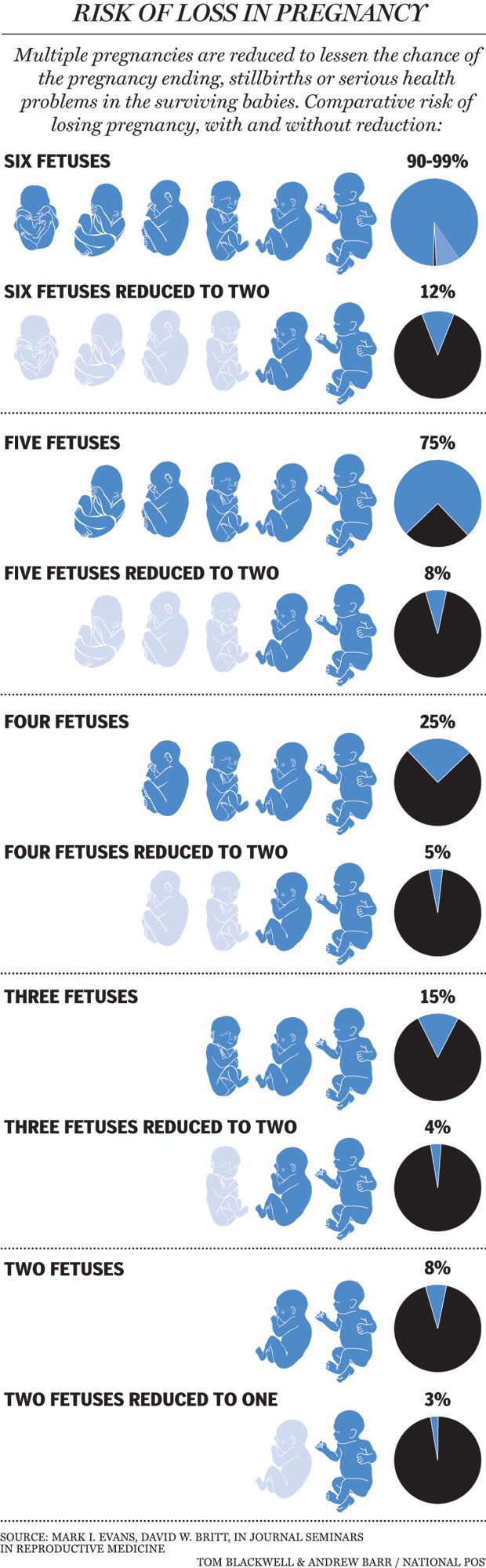 Graphic: Risk of loss in pregnacy | National Post
