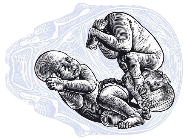 Twin births doubled in the past 30 years: study | National Post