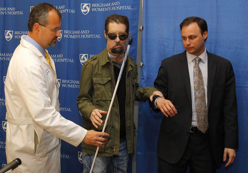 Dallas Wiens, face transplant recipient, in tears of joy after feeling ...