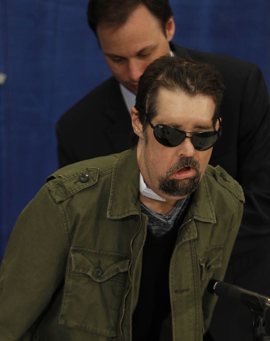 Dallas Wiens, face transplant recipient, in tears of joy after feeling ...