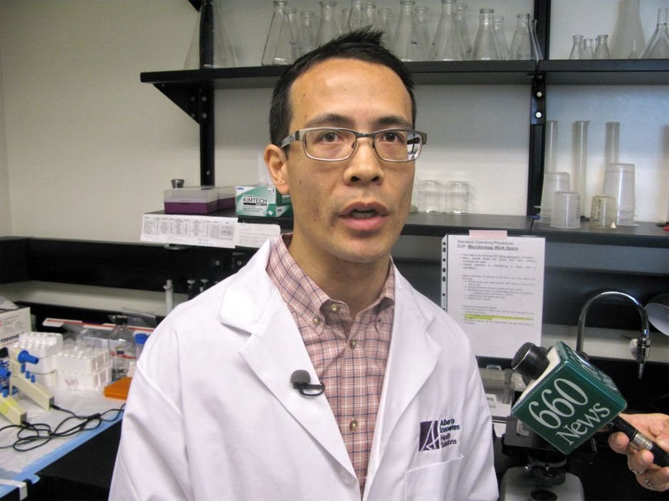Alberta researchers hopeful for sepsis treatment breakthrough ...