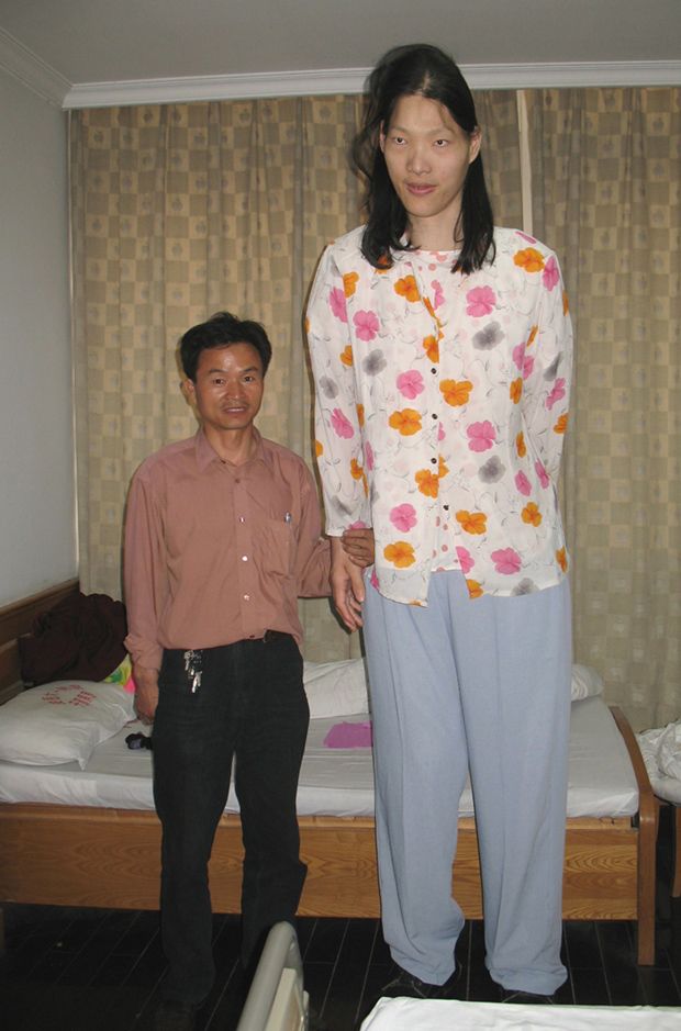 Yao Defen, world's tallest woman, dies after anguished life at 7-foot-7 ...
