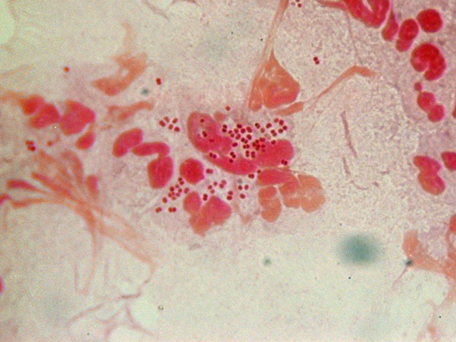 Antibiotic 'apocalypse' looms without action on bacterial resistance ...