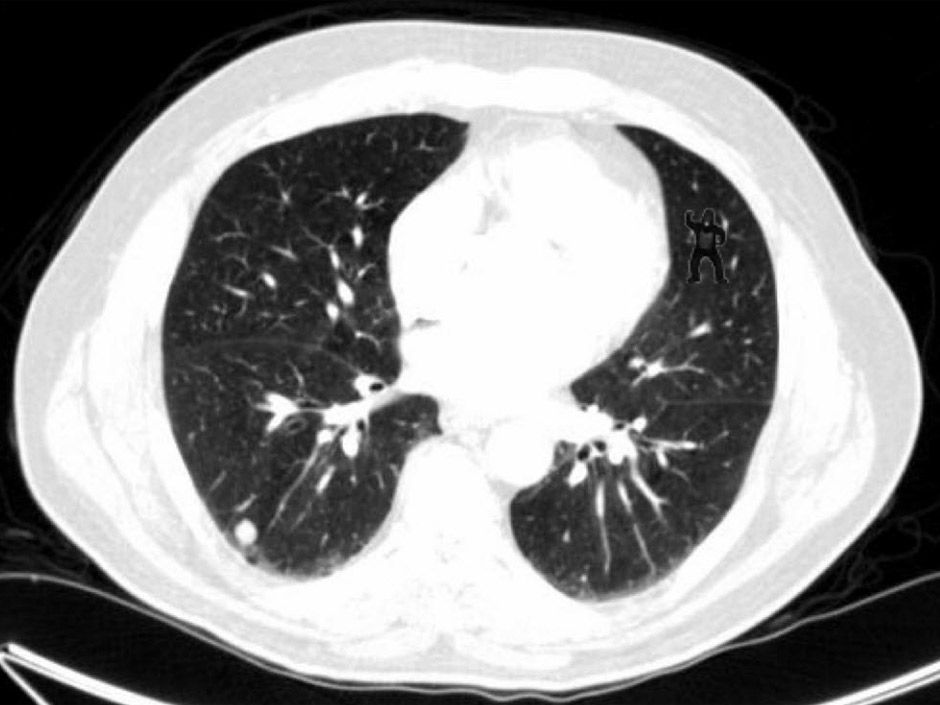 Dancing gorilla missed by radiologists in CT scan | National Post