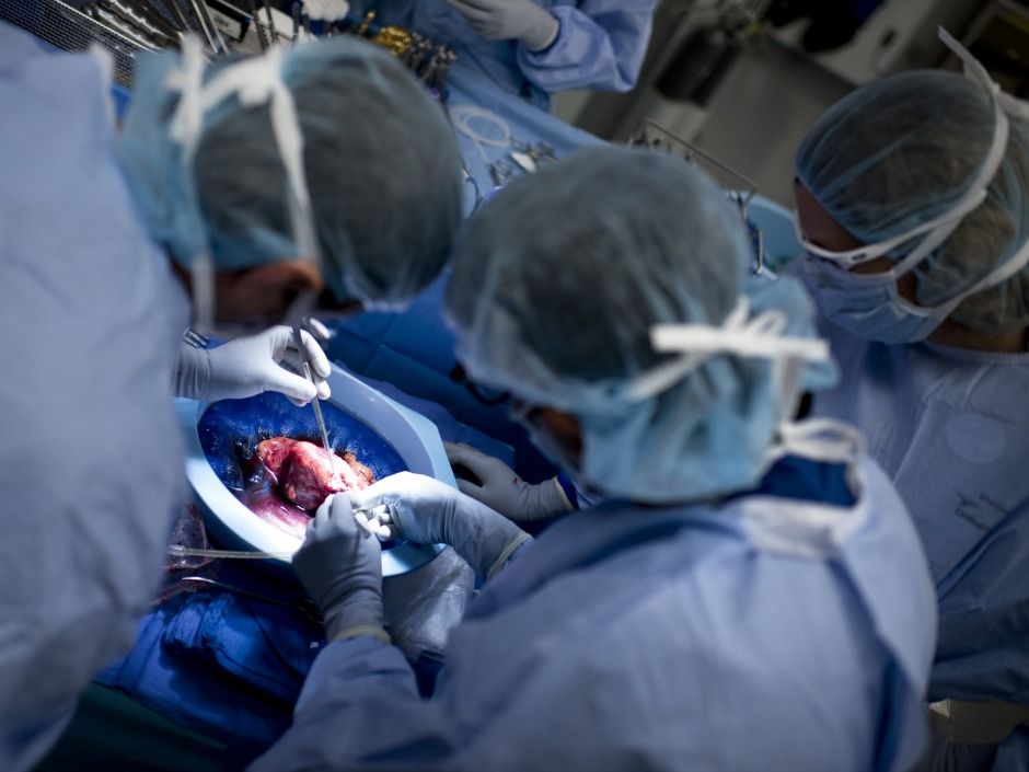 The way forward on organ donation | National Post