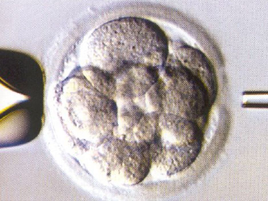 Human embryo experiment shows progress toward 'three-parent' babies ...