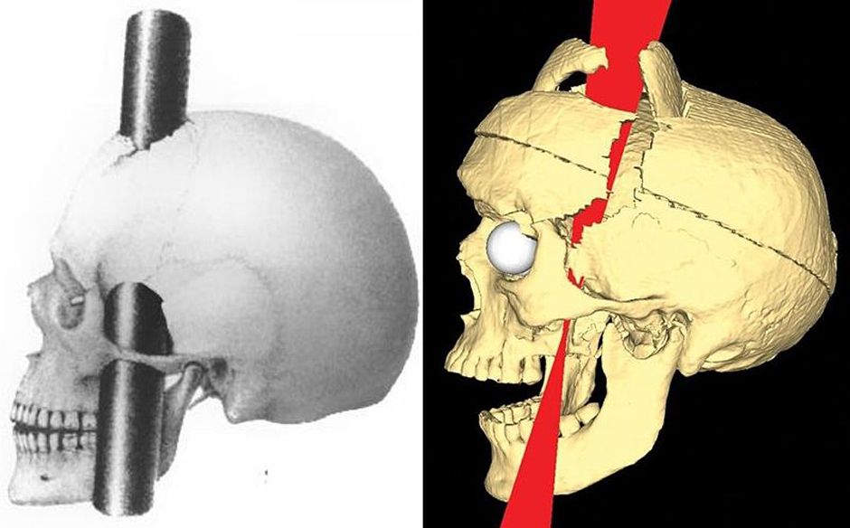 How Phineas Gage survived a horrific brain injury to become one of the ...