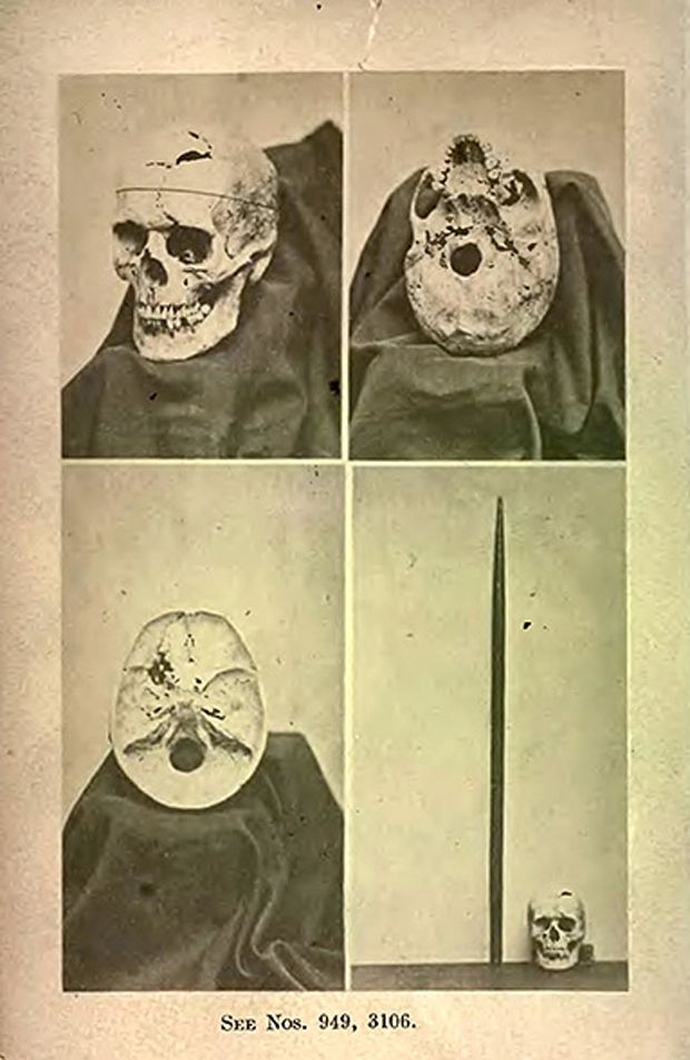 How Phineas Gage survived a horrific brain injury to become one of the ...