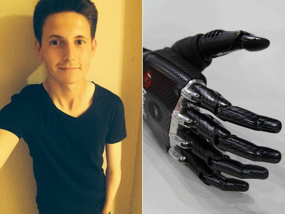 He just needs a (robotic) hand: B.C. teen crowdfunds for state-of-the ...