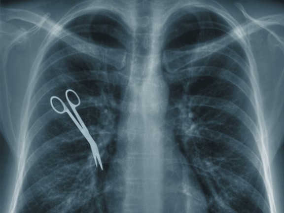 Wrong body part, wrong procedure, wrong patient: A rare look at ...