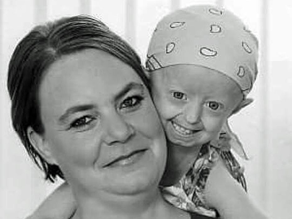 British teenager Hayley Okines dies at age 17 of rare disease that ...