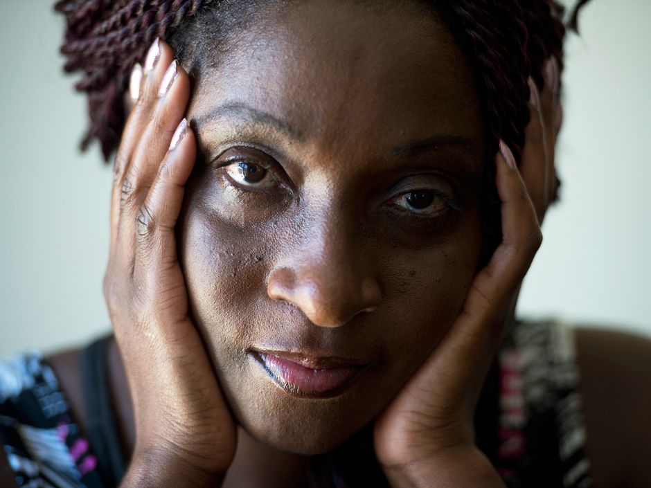 Traumatic, sometimes deadly, skin condition persists in Canada despite ...