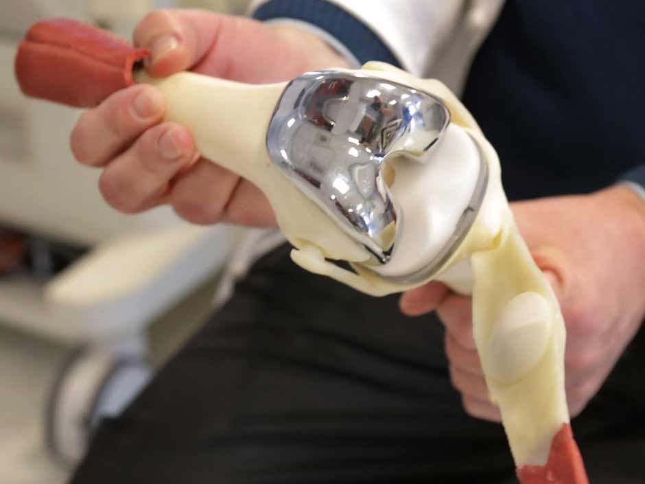 Knee replacement surgery gives more pain relief, but riskier: study ...