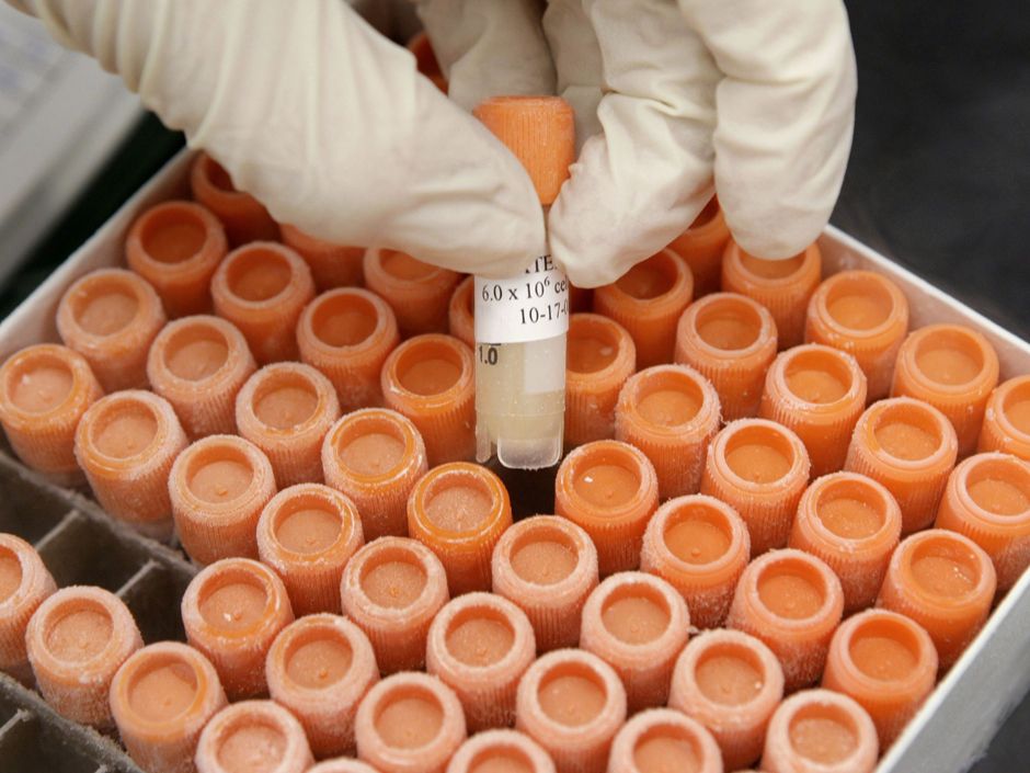 Stanford researchers 'stunned' by stem cell experiment that helped ...