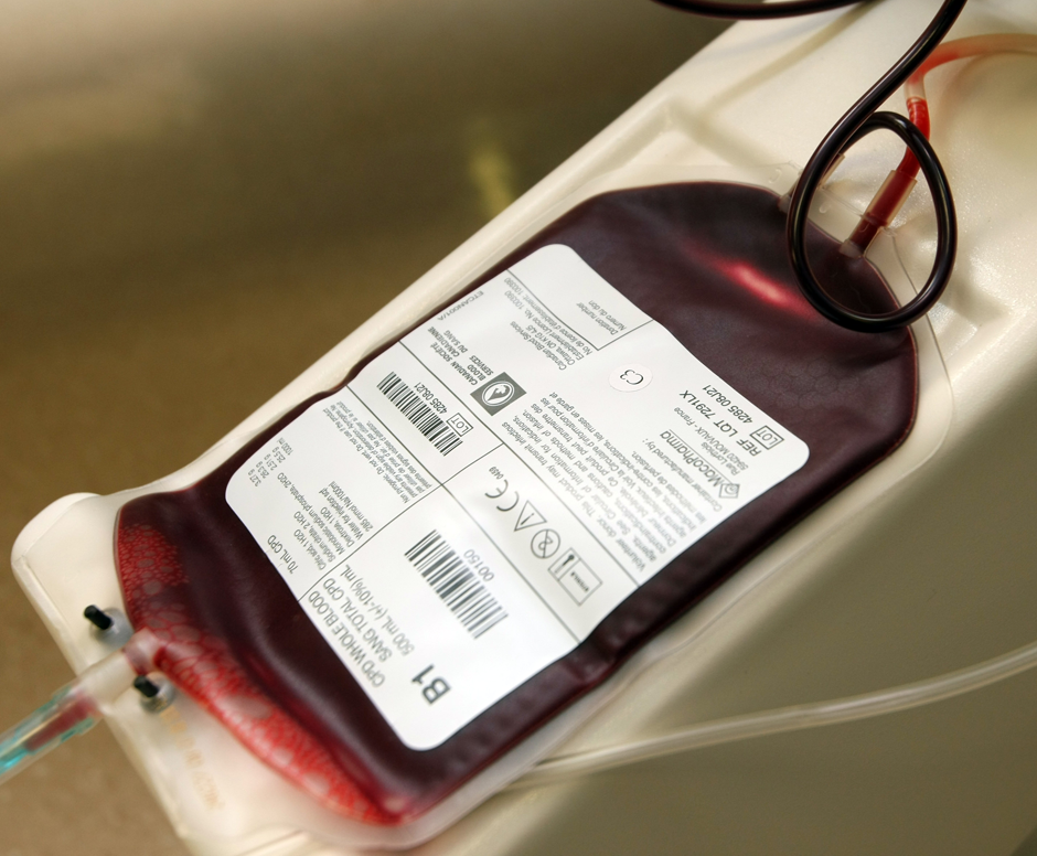 Victims of Canada’s tainted blood scandal to share $207M compensation ...