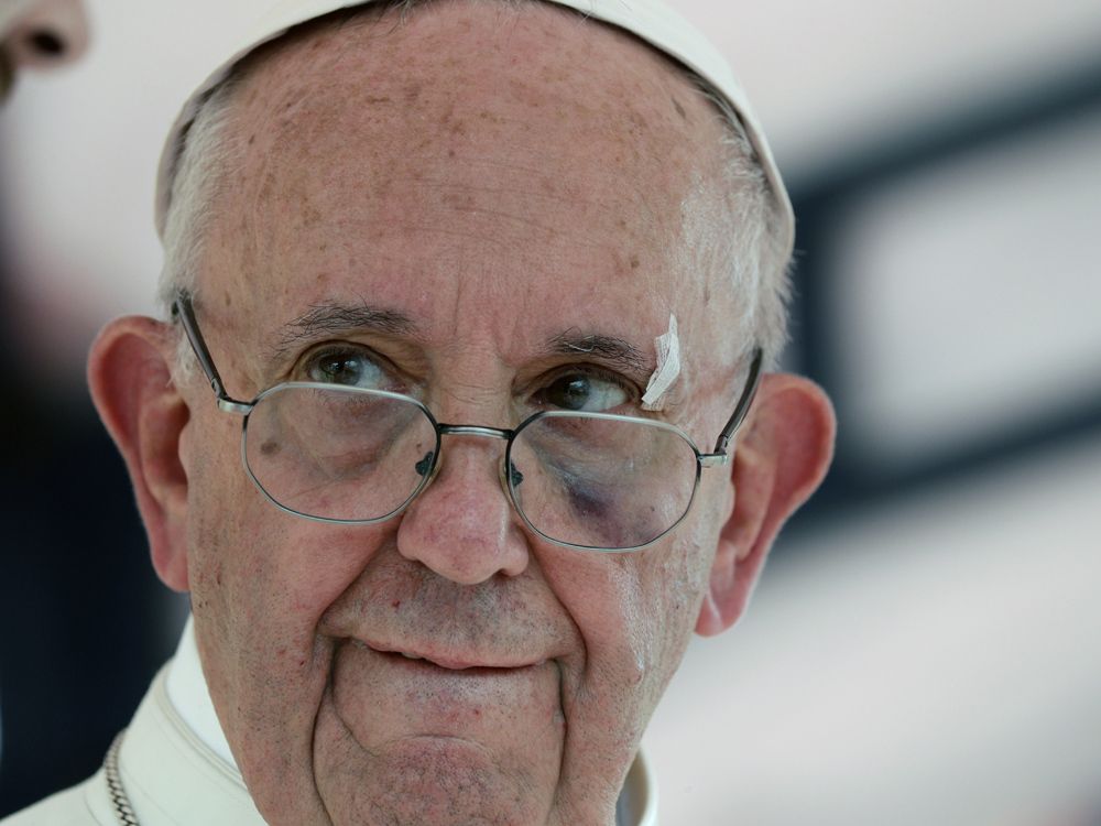 Pope gets black eye after hitting his head on popemobile during ...