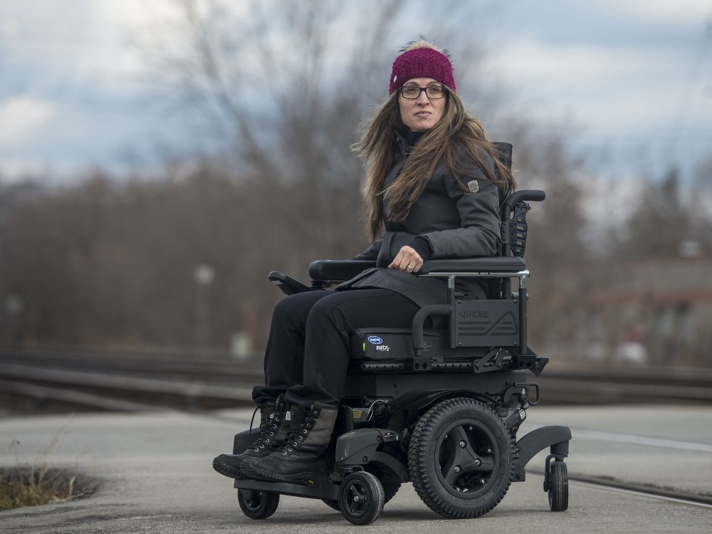 This woman survived life-threatening sepsis, but what came next was ...