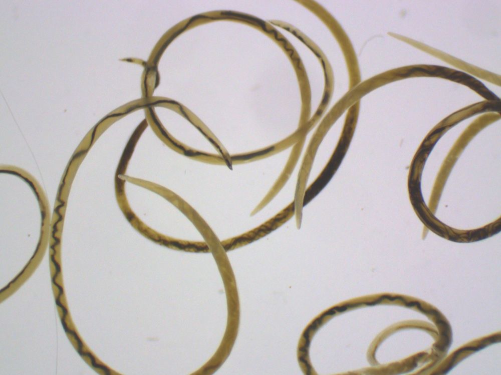 Eating a snail could do much worse than just make you sick — Australian ...