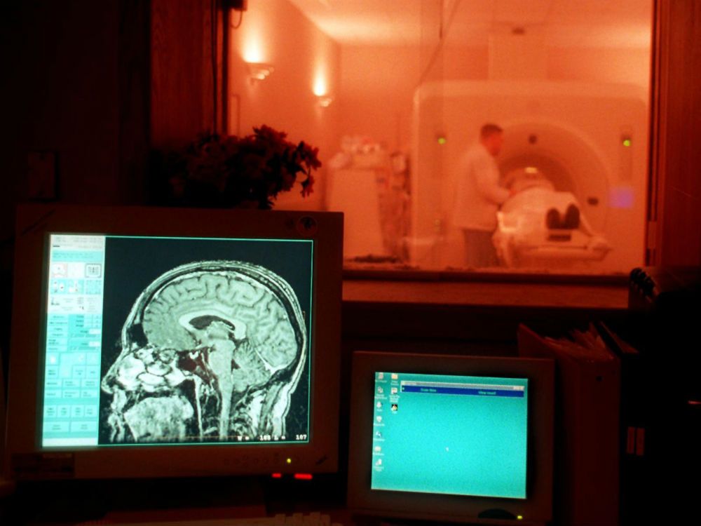 An MRI brain scan can reveal if you are transgender, says study ...