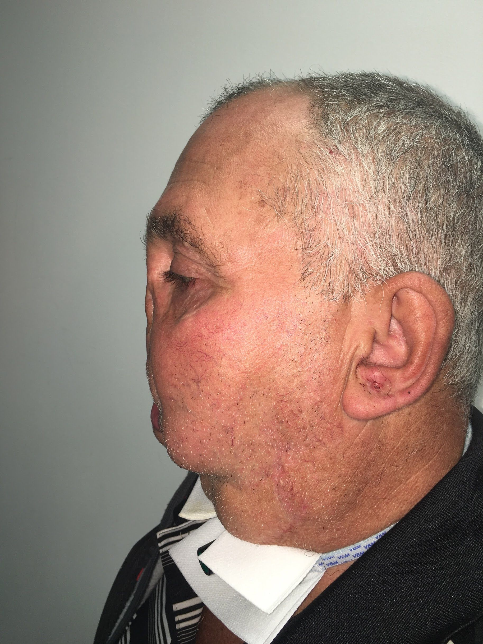 Canada's first face transplant | National Post