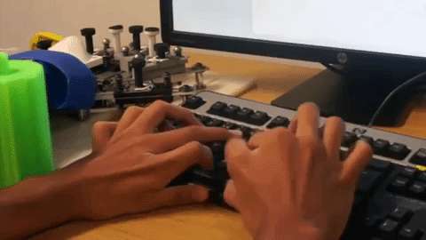 Sixth finger not a useless mutation, scientists say after brain scans ...