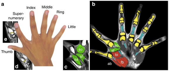 Sixth finger not a useless mutation, scientists say after brain scans ...