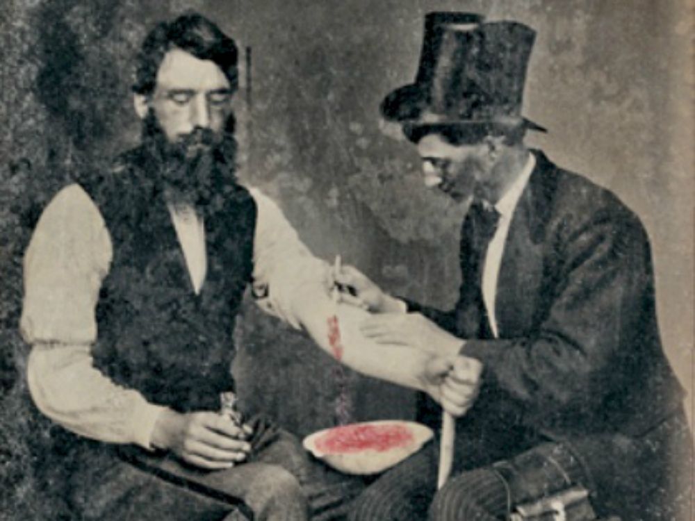 A man's blood was so fatty it looked like milk. Doctors used an ancient ...