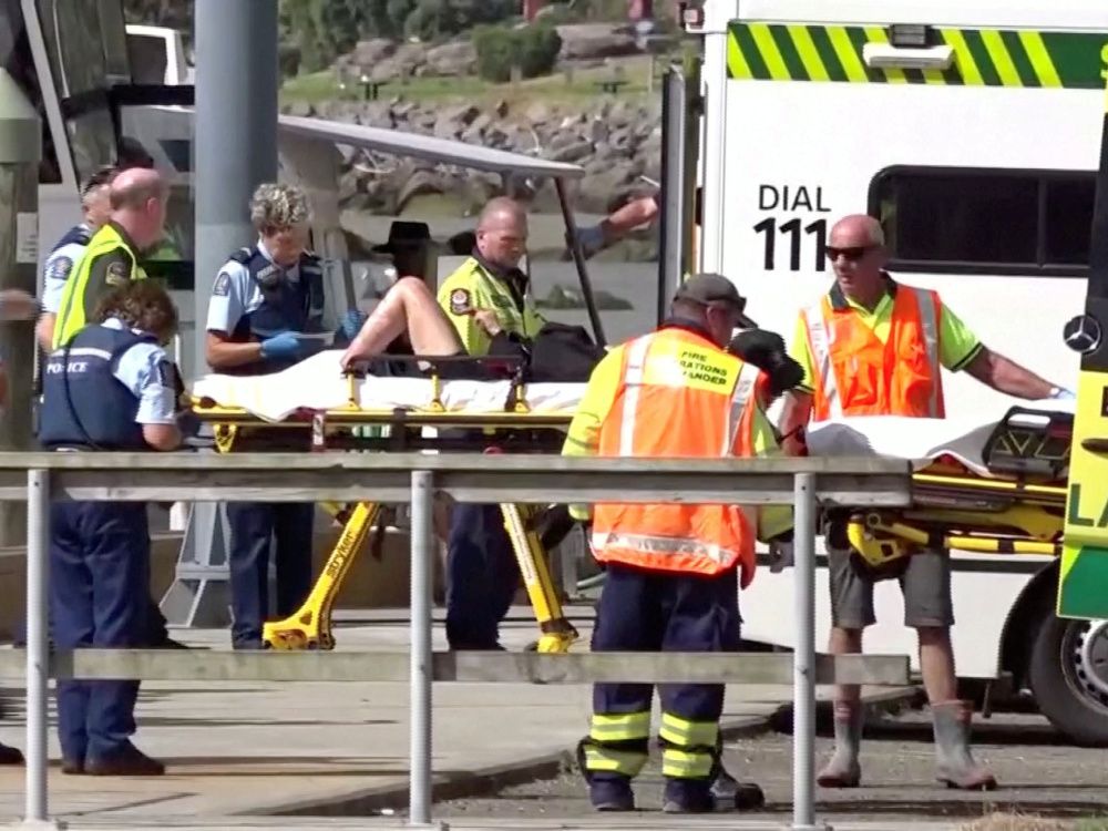 New Zealand has ordered 120 square meters of human skin to treat ...