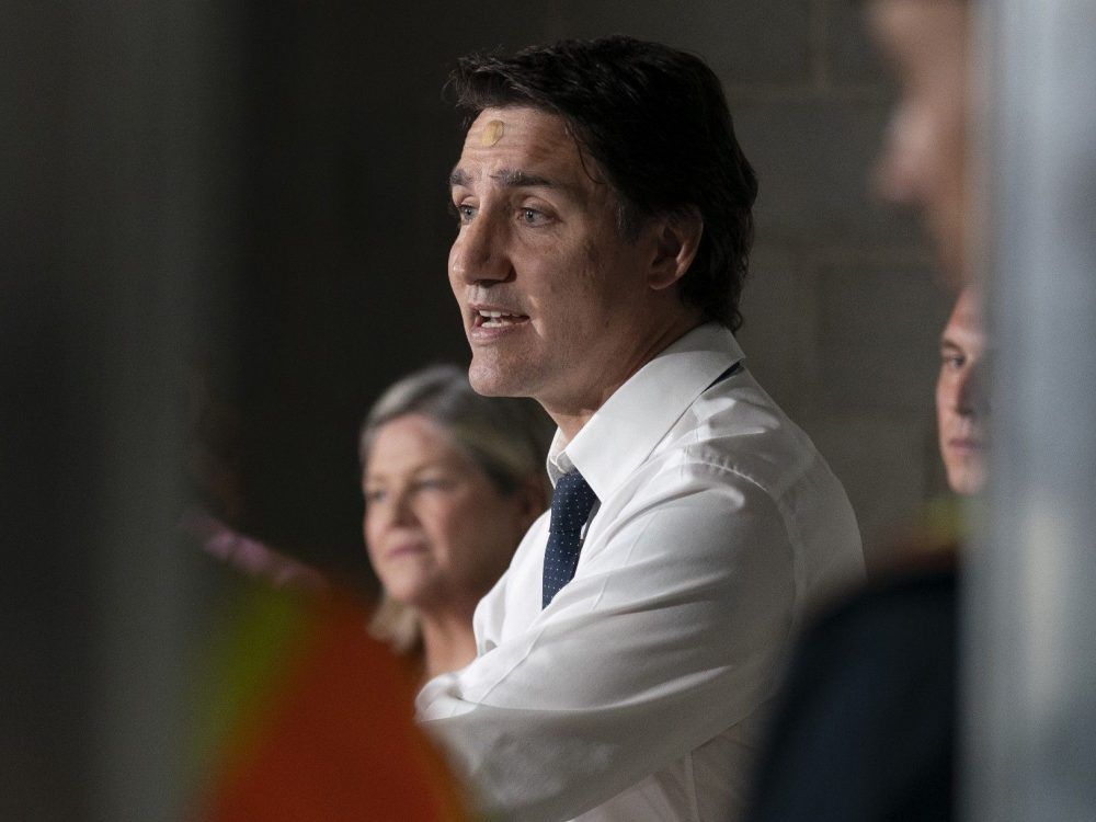 Justin Trudeau appeared at news conference with bandage on forehead ...