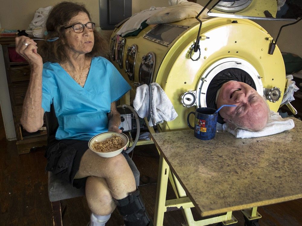 Paul Alexander thrived while using iron lung after contracting polio as ...
