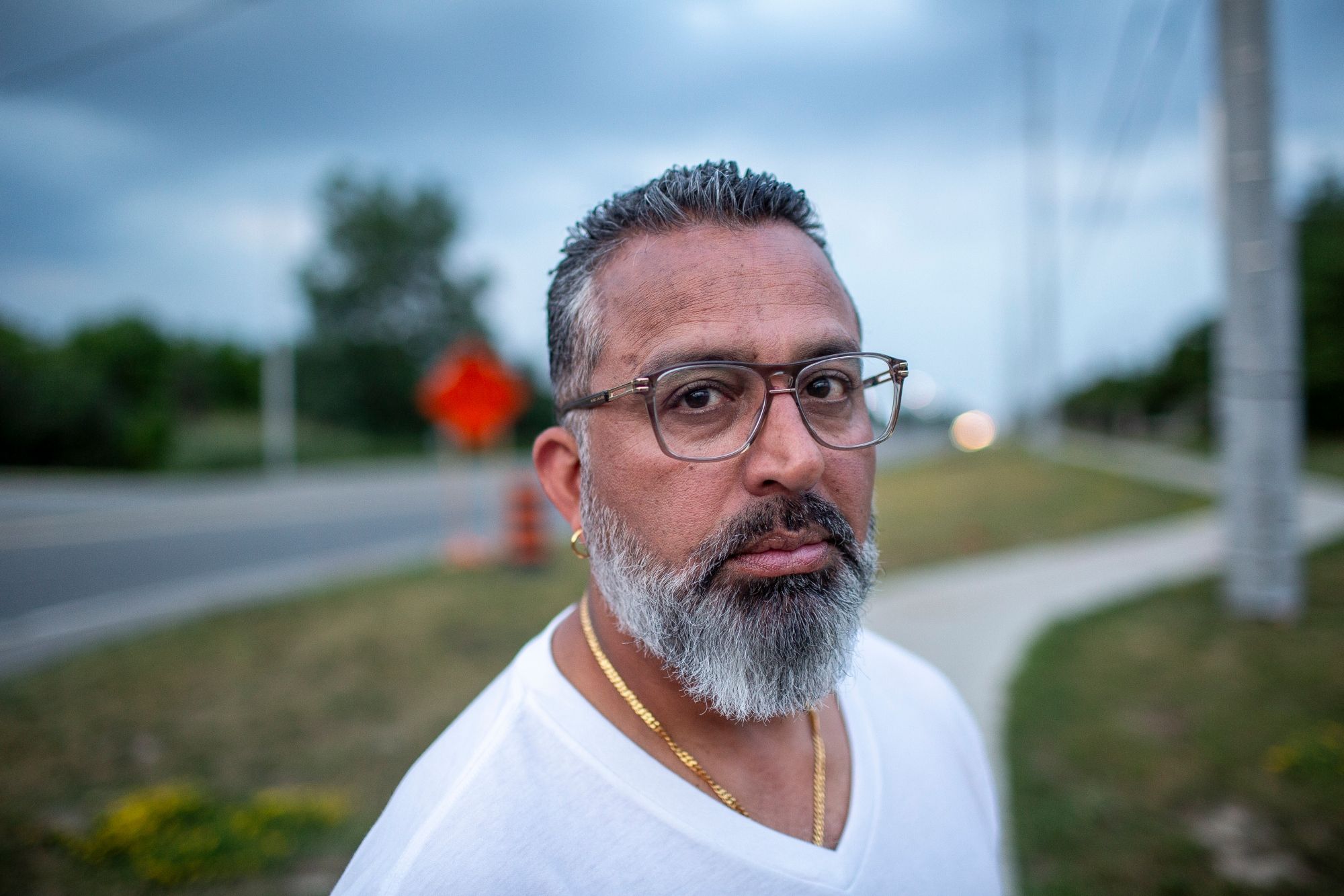 Shingles left this Brampton man with permanent scarring on his face ...
