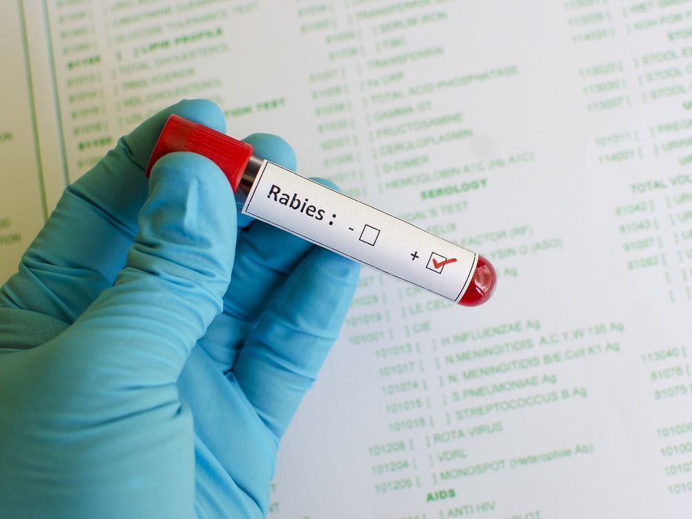 Renfrew County and District Health Unit confirms bat tests positive for ...