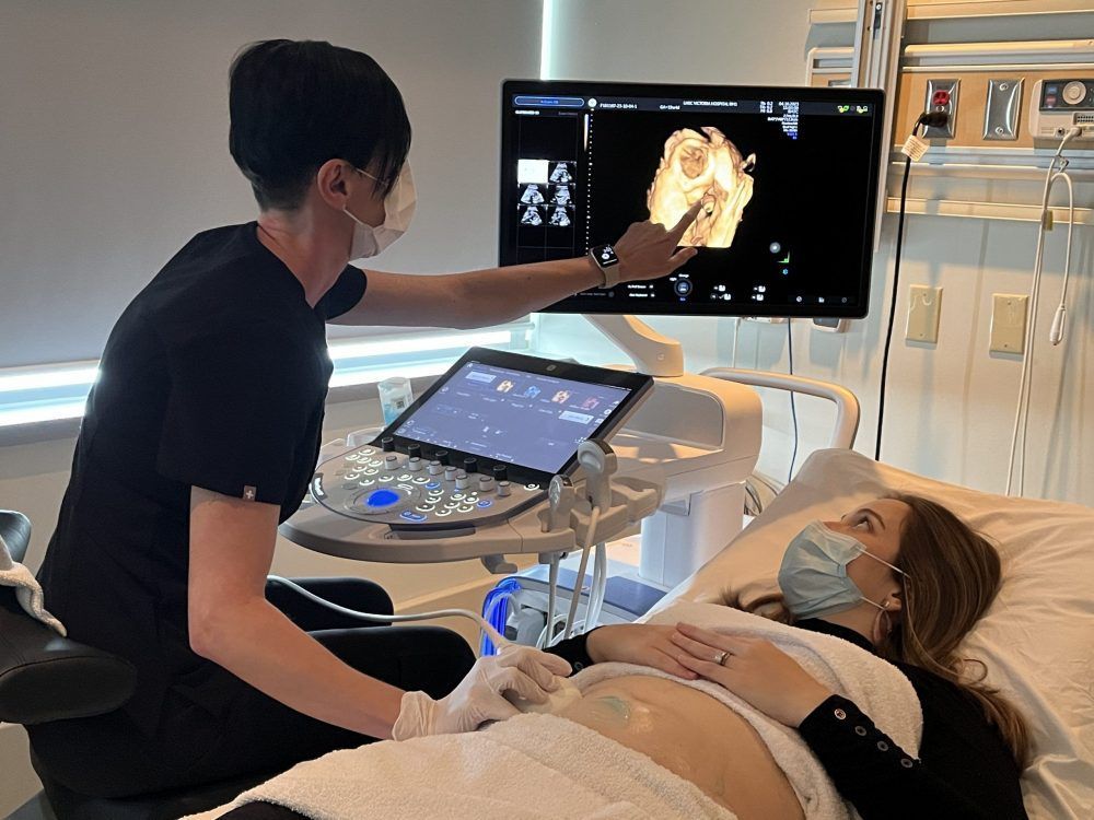 New LHSC ultrasound machines show fetus in 'so much detail' | St ...